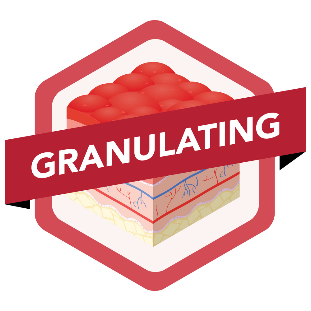 Wound Guide - Fungating – Advancis Medical