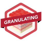 Wound Guide - Fungating – Advancis Medical