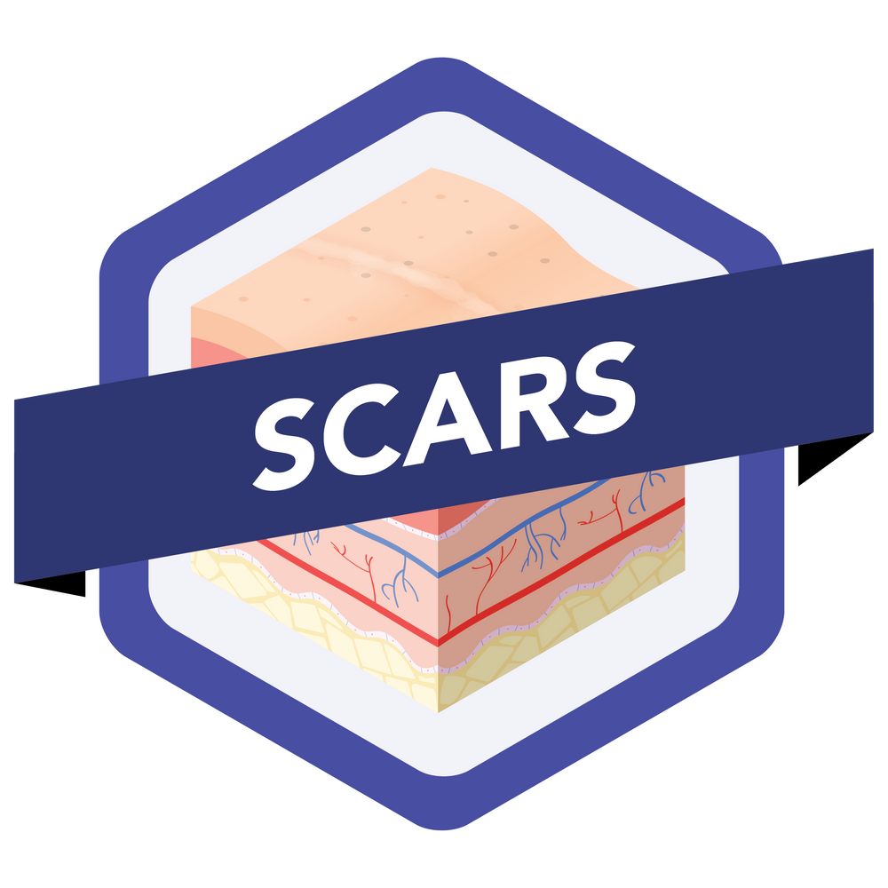 Wound Guide - Fungating – Advancis Medical