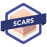 Wound Guide - Fungating – Advancis Medical