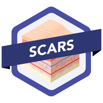 Wound Guide - Necrotic – Advancis Medical