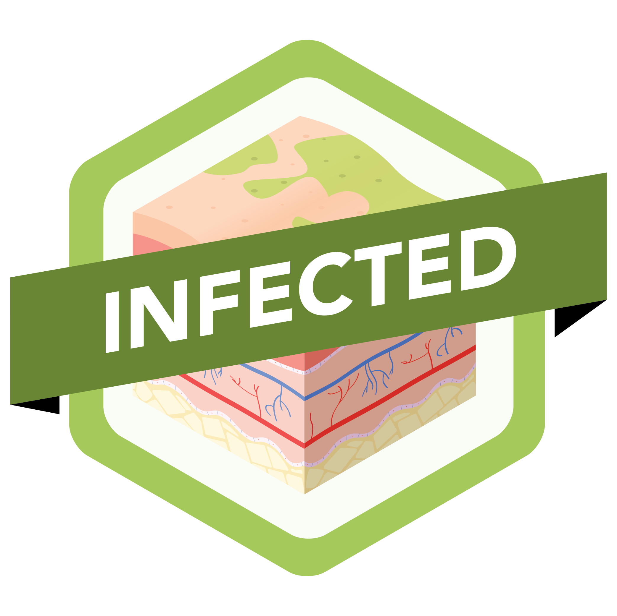 Wound Guide – Advancis Medical