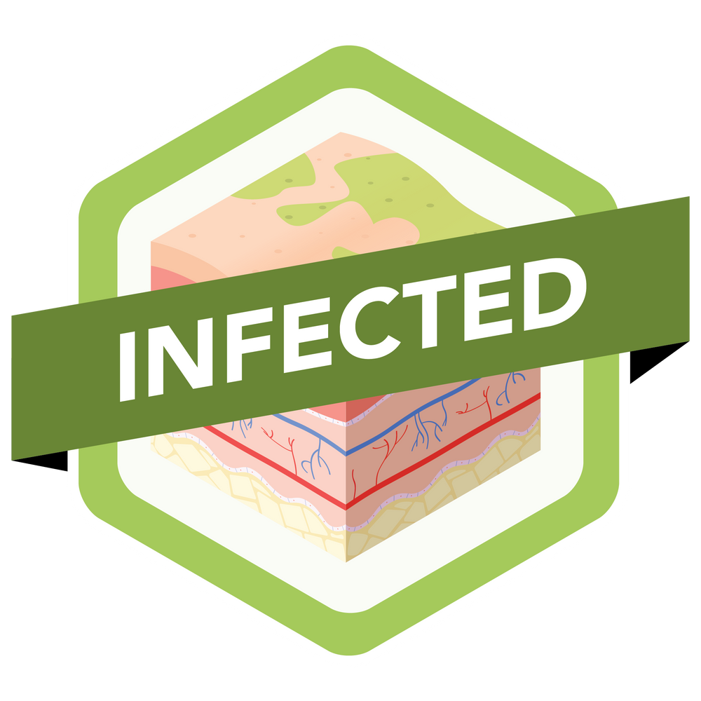 Wound Guide – Advancis Medical