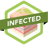 Wound Guide - Fungating – Advancis Medical